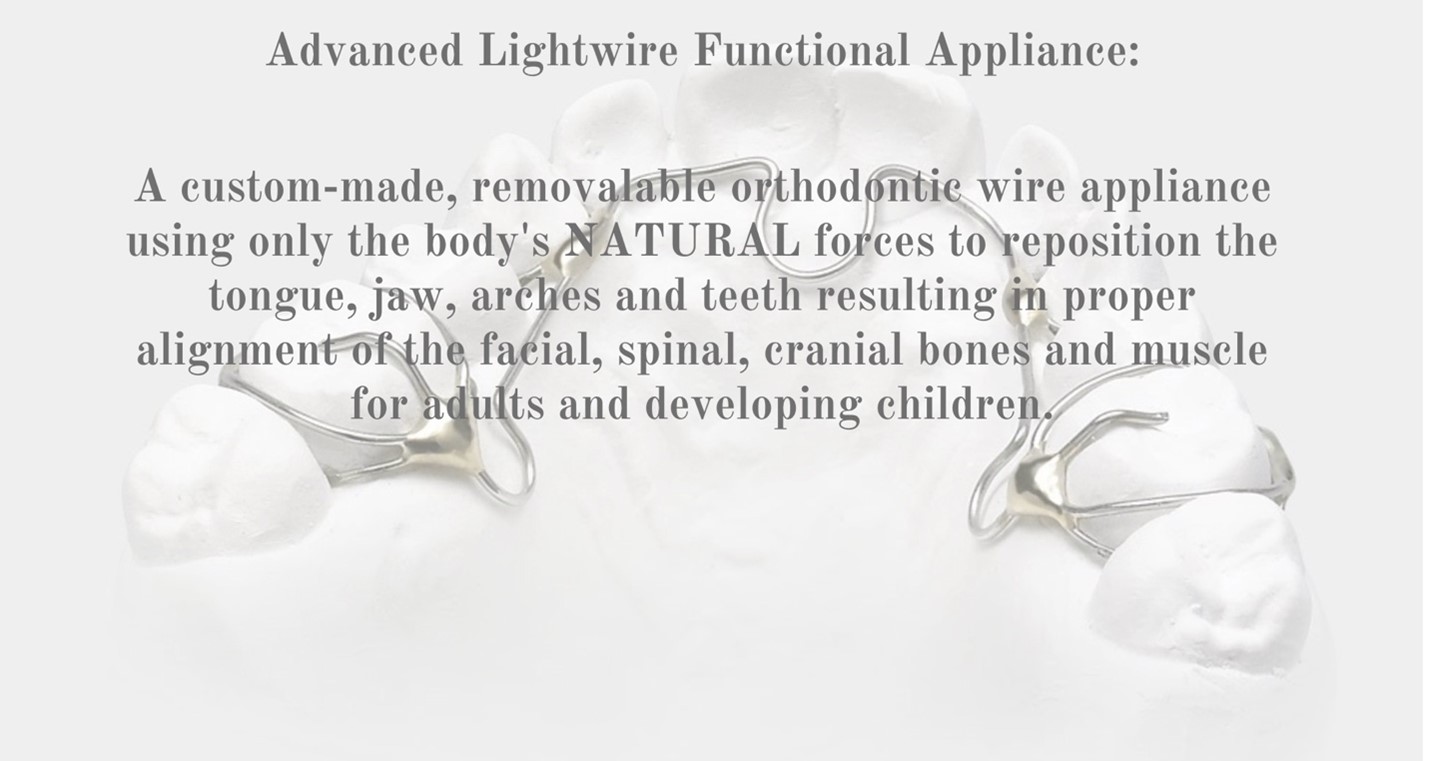 Advanced Lightwire Functional Appliance | Dentist Arlington, VA