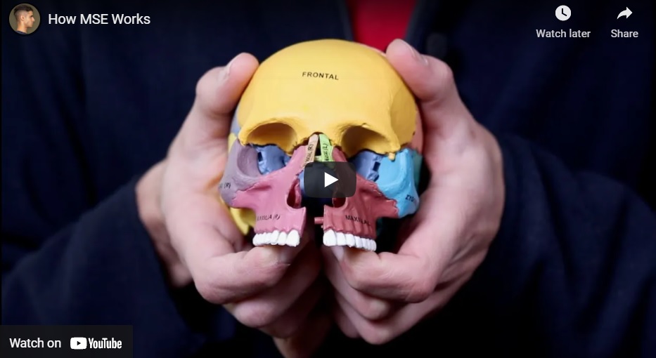 Maxillary Skeletal Expansion (MSE) | Dentist Arlington, VA